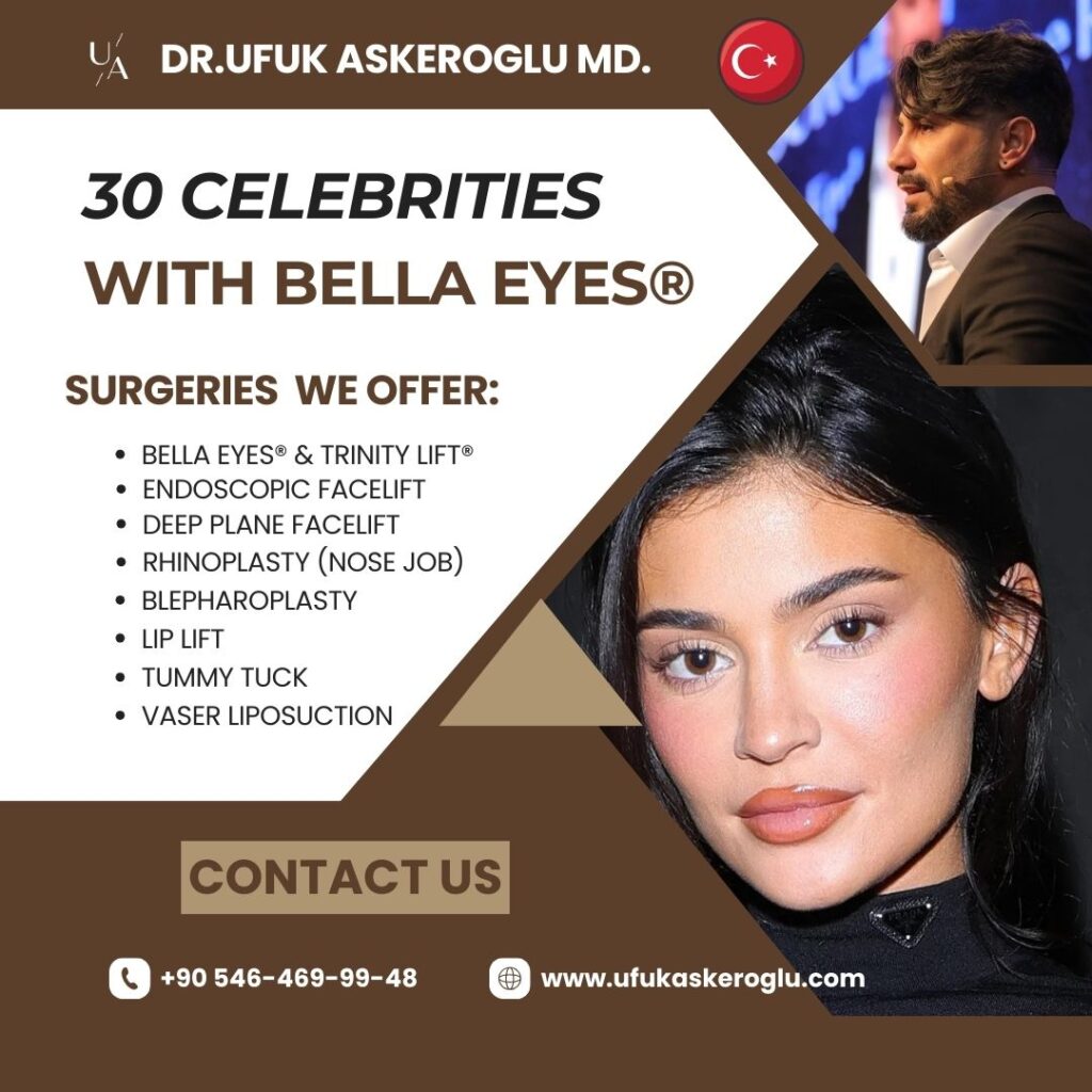 Celebrities With Bella Eyes - Ufuk Askeroğlu