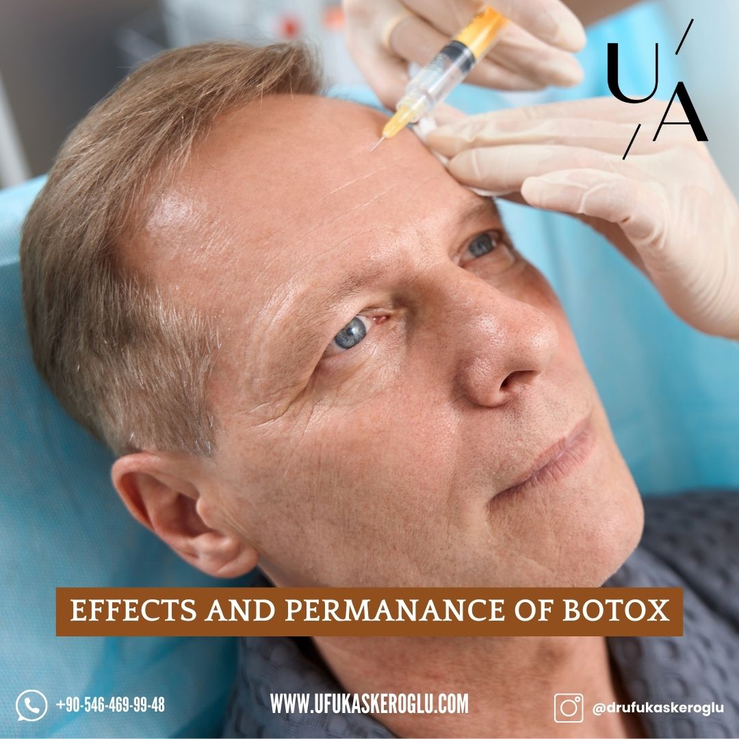 Botoks Nedir - Ufuk Askeroğlu