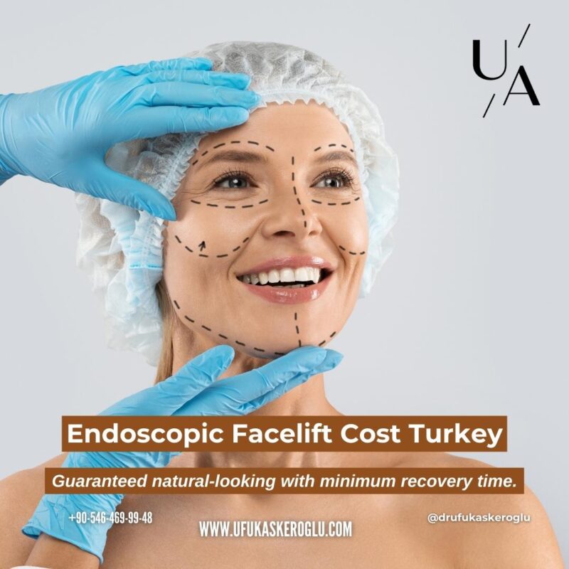 Endoscopic facelift cost Turkey - Ufuk Askeroğlu